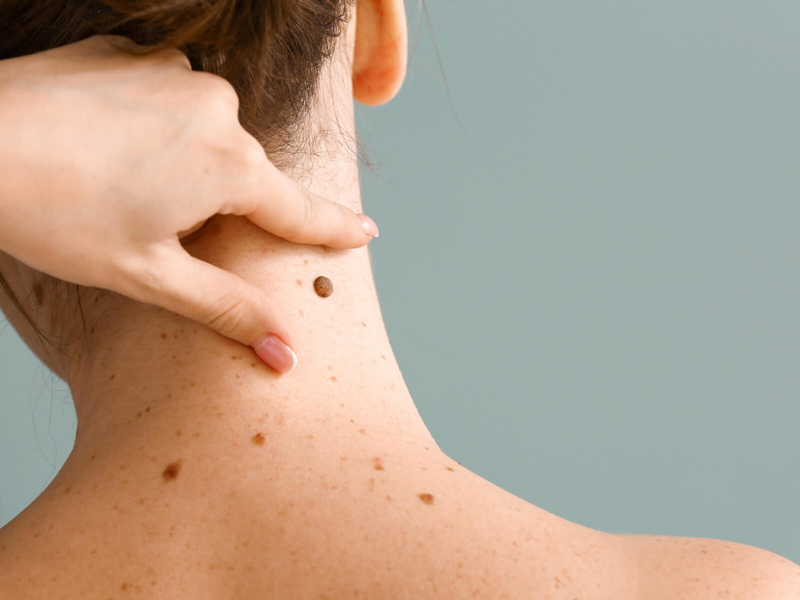 Mladeži - Poliklinike "Alta Medika"